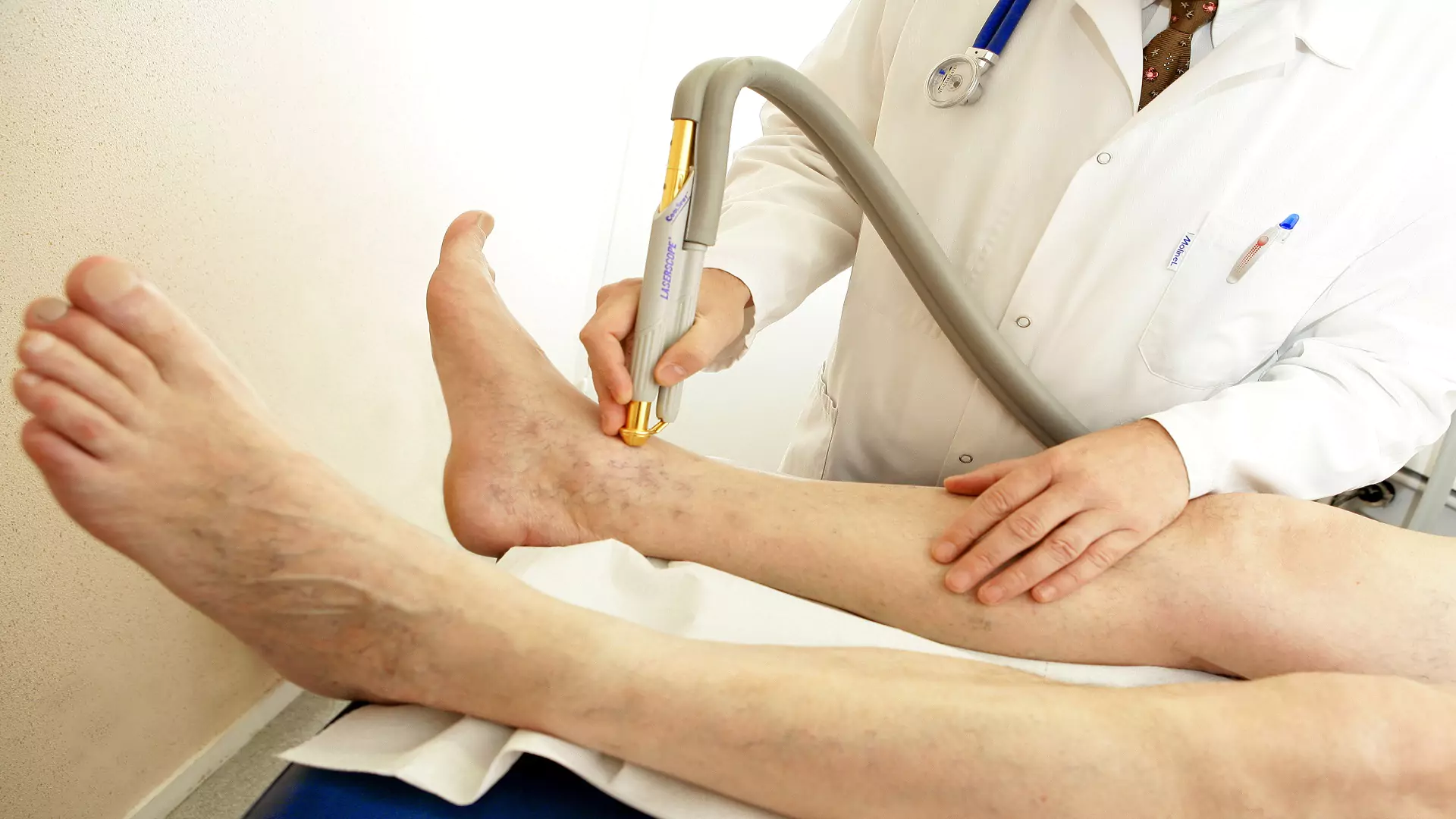 How Is Radiofrequency And Laser Varicose Vein Treatment Performed?